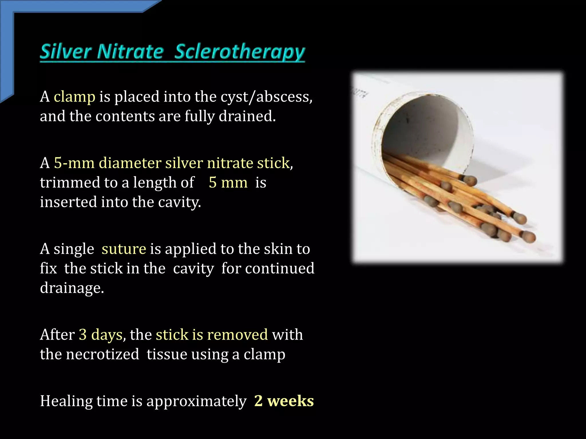 Bartholin gland cyst | PPTX