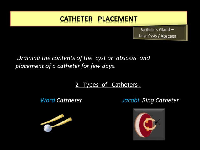 Bartholin gland cyst | PPTX