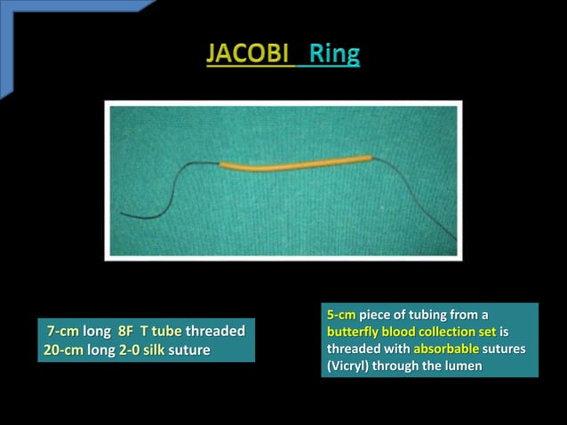 Bartholin Gland Cyst Ppt