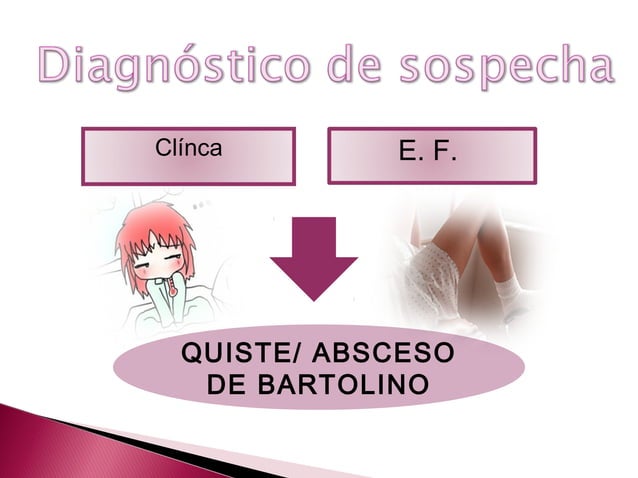 Bartolinitis | PPT