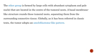 Basal Cell Adenoma | PPTX