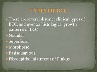 Basal cell carcinoma | PPTX