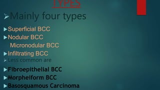 Basal cell carcinoma | PPTX