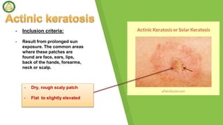 Basal cell carcinoma | PPTX