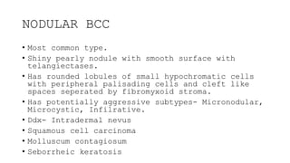 Skin Cancer- Basal Cell Carcinoma Most Common | PPT