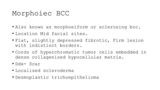 Skin Cancer- Basal Cell Carcinoma Most Common | PPTX