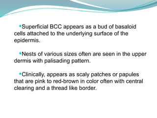 BASAL_CELL_CARCINOMA basal cell carcinoma sunlight exposure.pptx