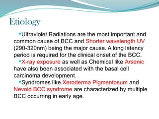 BASAL_CELL_CARCINOMA basal cell carcinoma sunlight exposure.pptx