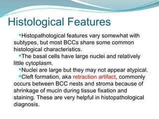 BASAL_CELL_CARCINOMA basal cell carcinoma sunlight exposure.pptx
