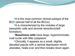 BASAL_CELL_CARCINOMA basal cell carcinoma sunlight exposure.pptx