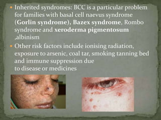 Basal Cell Carcinoma Complete Overview Presentation | PPTX