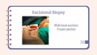 Basal cell carcinoma A case report.pptx