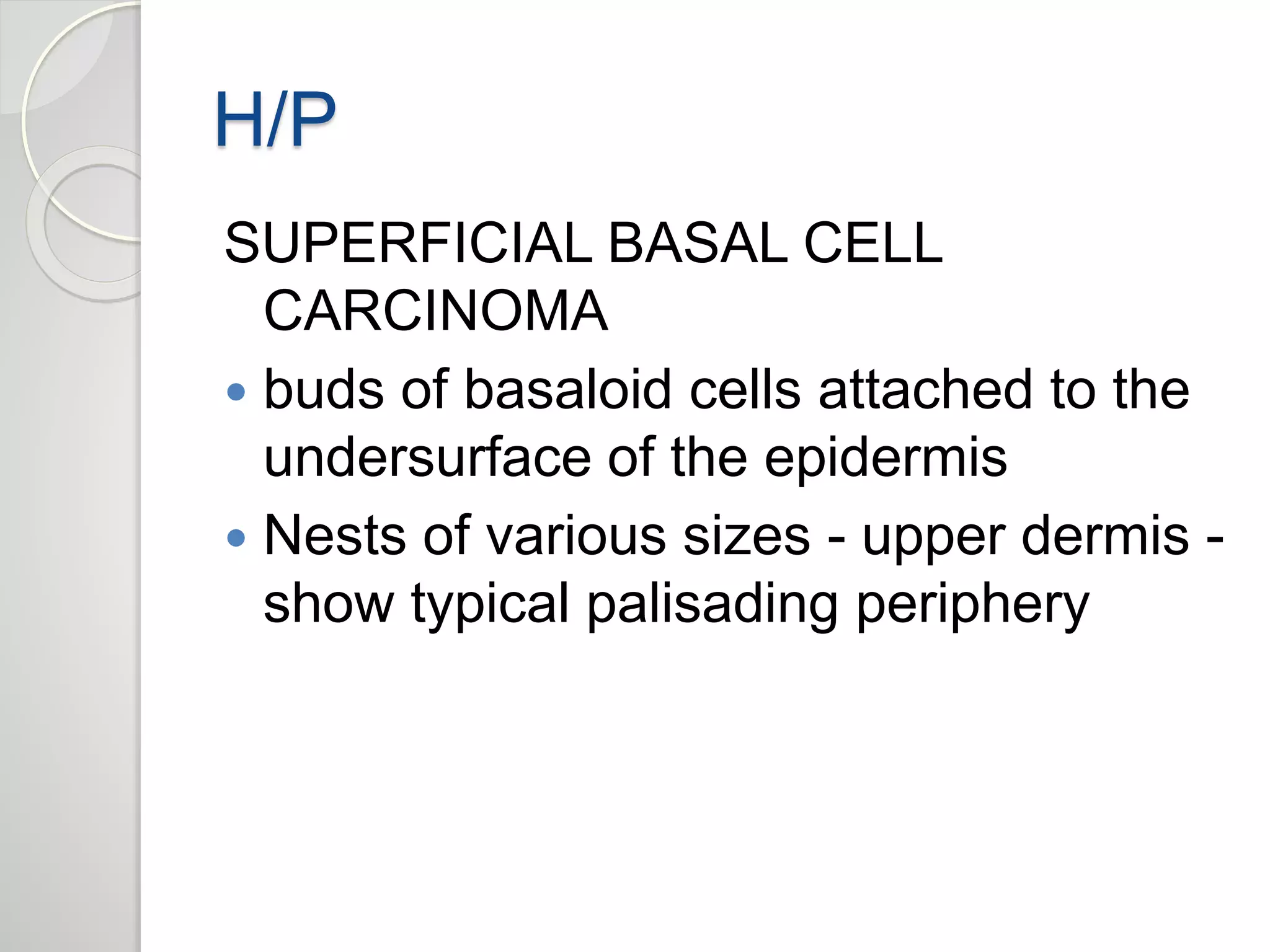 Basal cell carcinoma of oral cavity | PPTX
