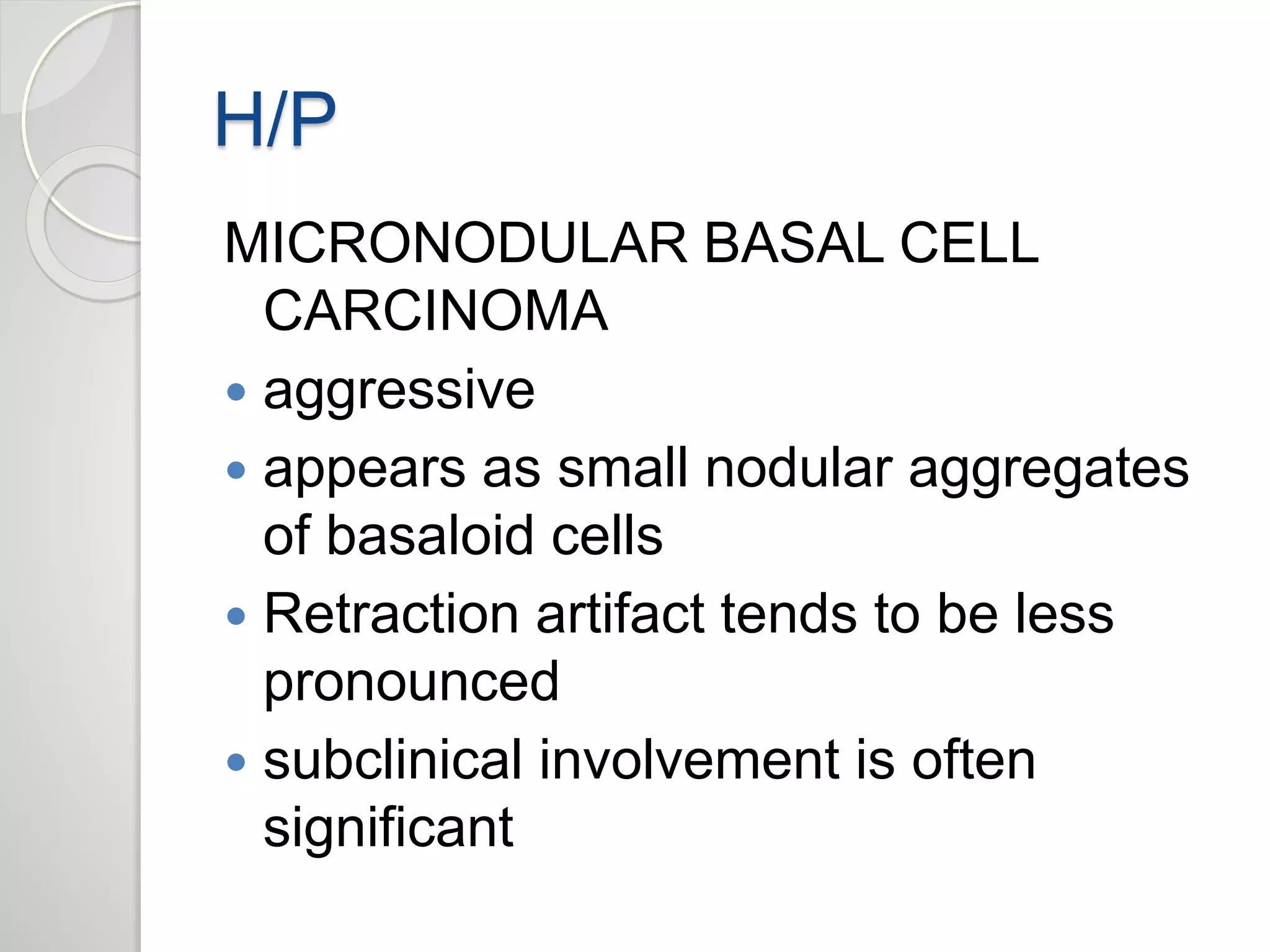 Basal cell carcinoma of oral cavity | PPTX