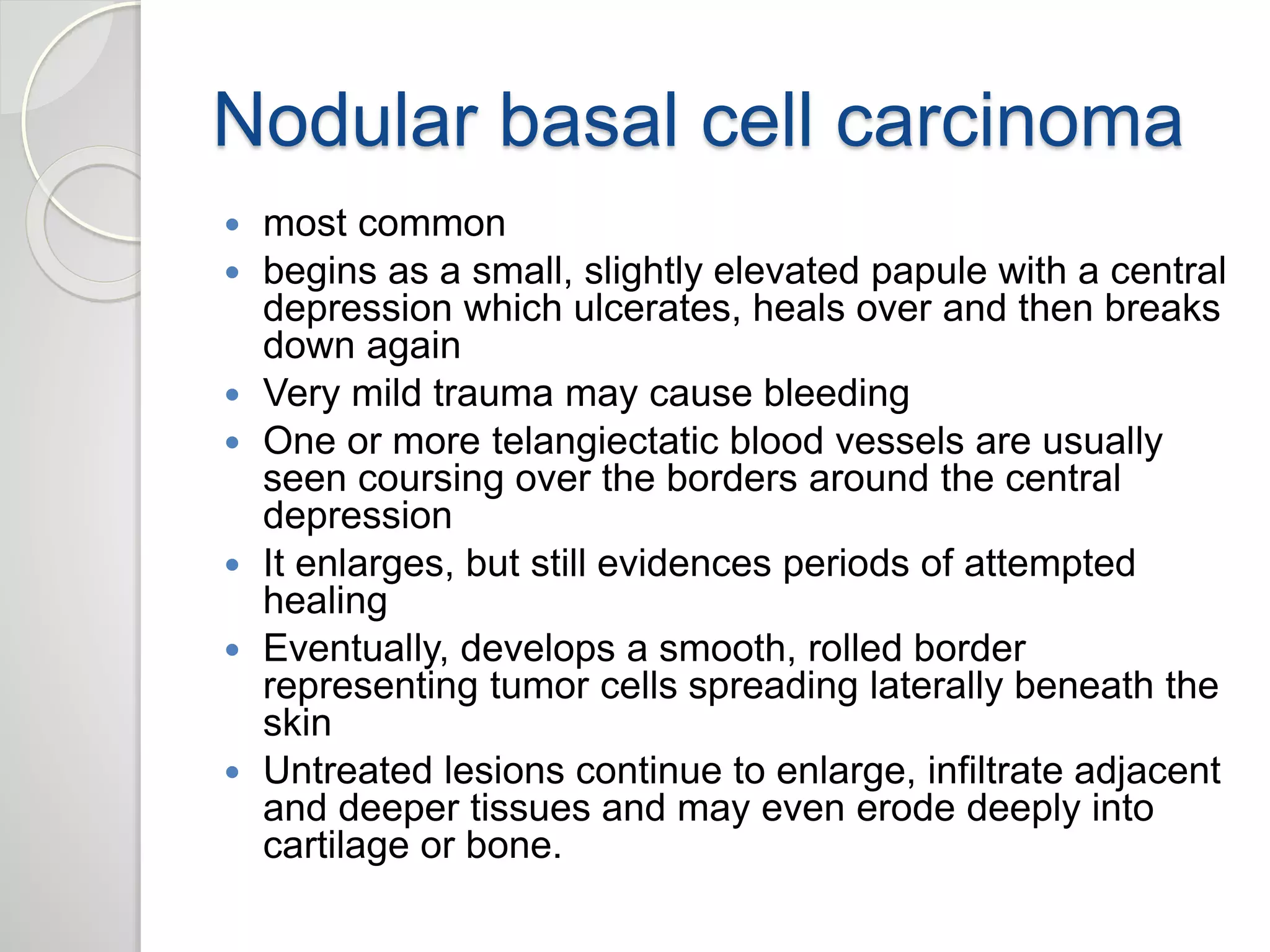 Basal cell carcinoma of oral cavity | PPTX