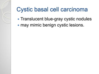 Basal cell carcinoma of oral cavity | PPTX