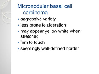 Basal cell carcinoma of oral cavity | PPTX