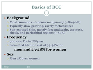 Basal cell carcnoma | PPTX