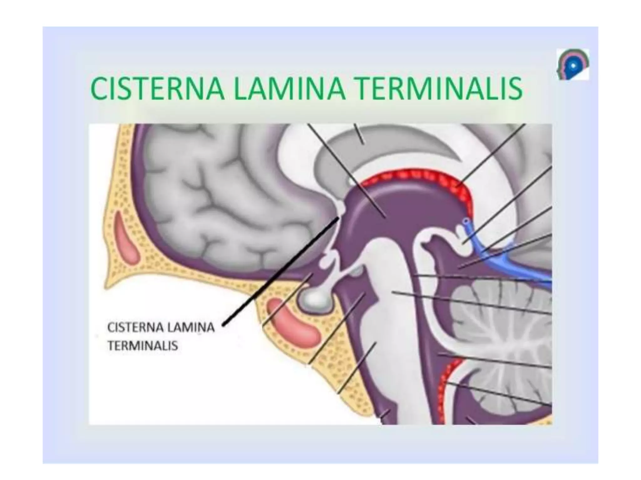 basal cisterns final.ppt