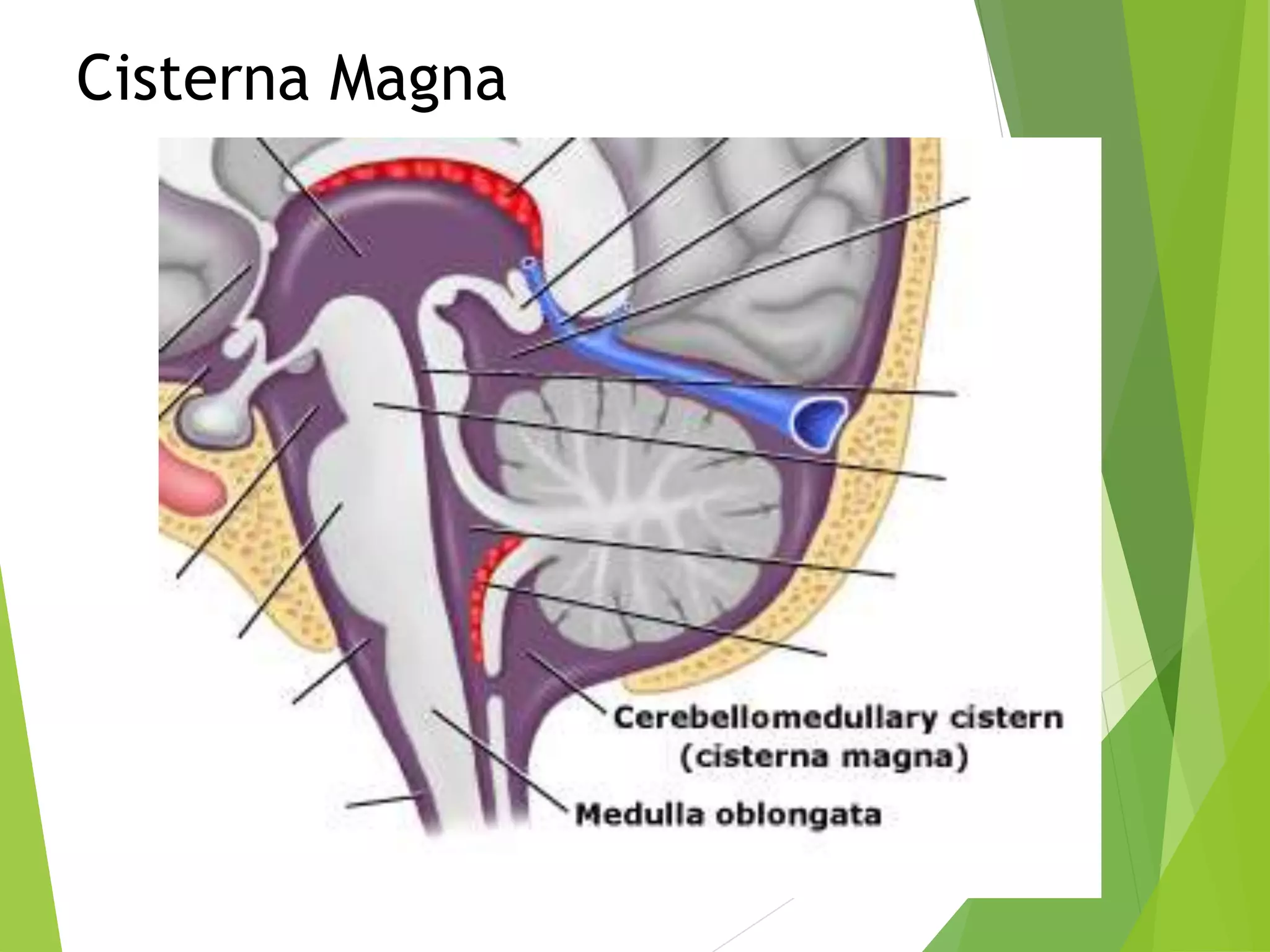 basal cisterns final.ppt