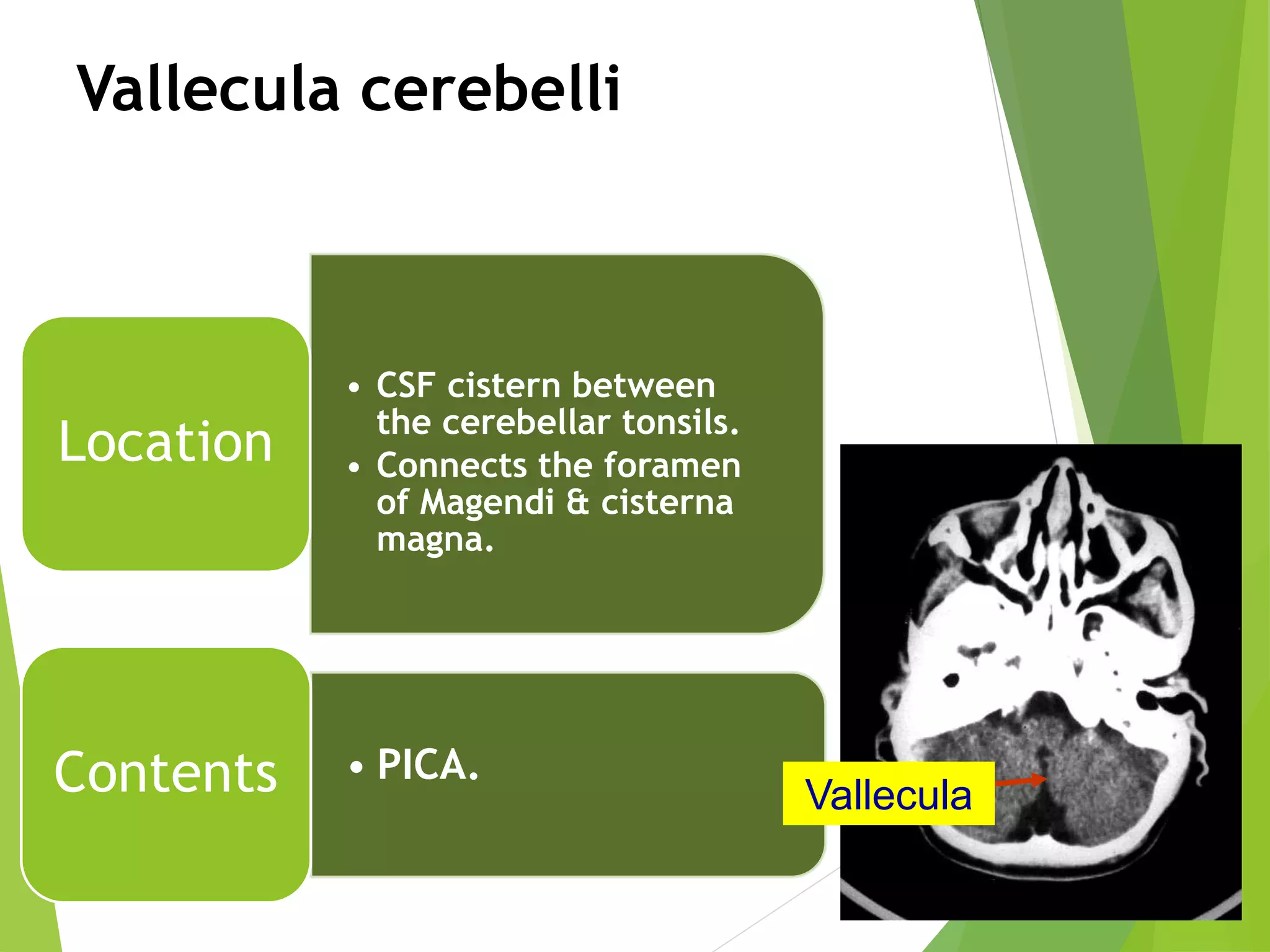 basal cisterns final.ppt
