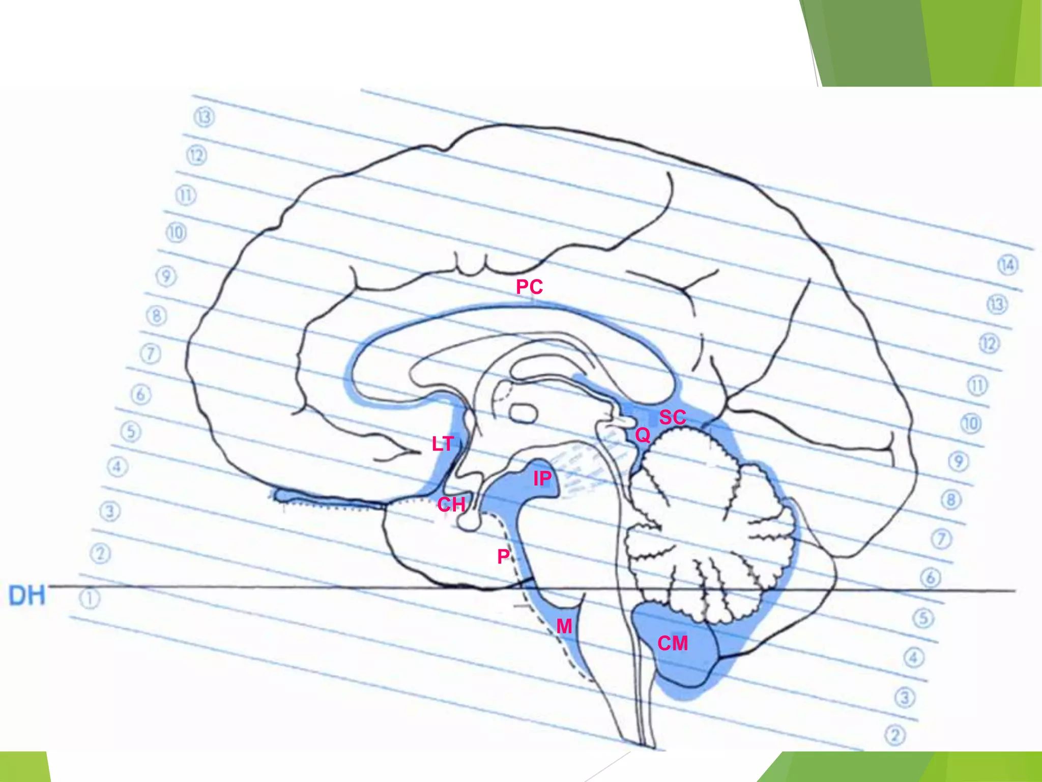 basal cisterns final.ppt