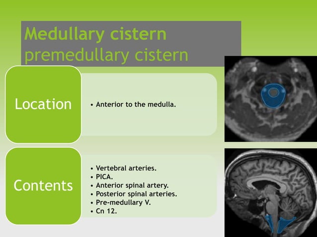 basal cisterns final.ppt