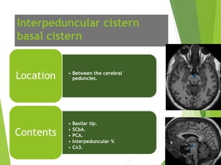 basal cisterns final.ppt