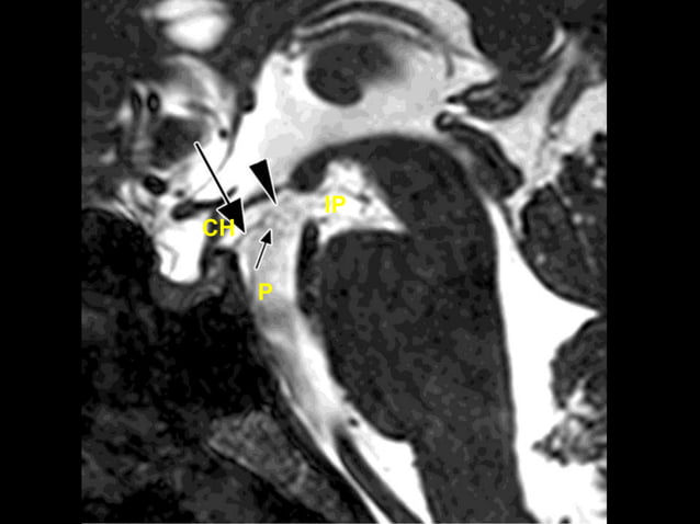 basal cisterns final.ppt