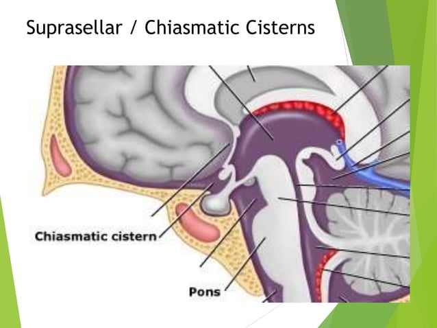 basal cisterns final.ppt