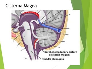 basal cisterns final.ppt