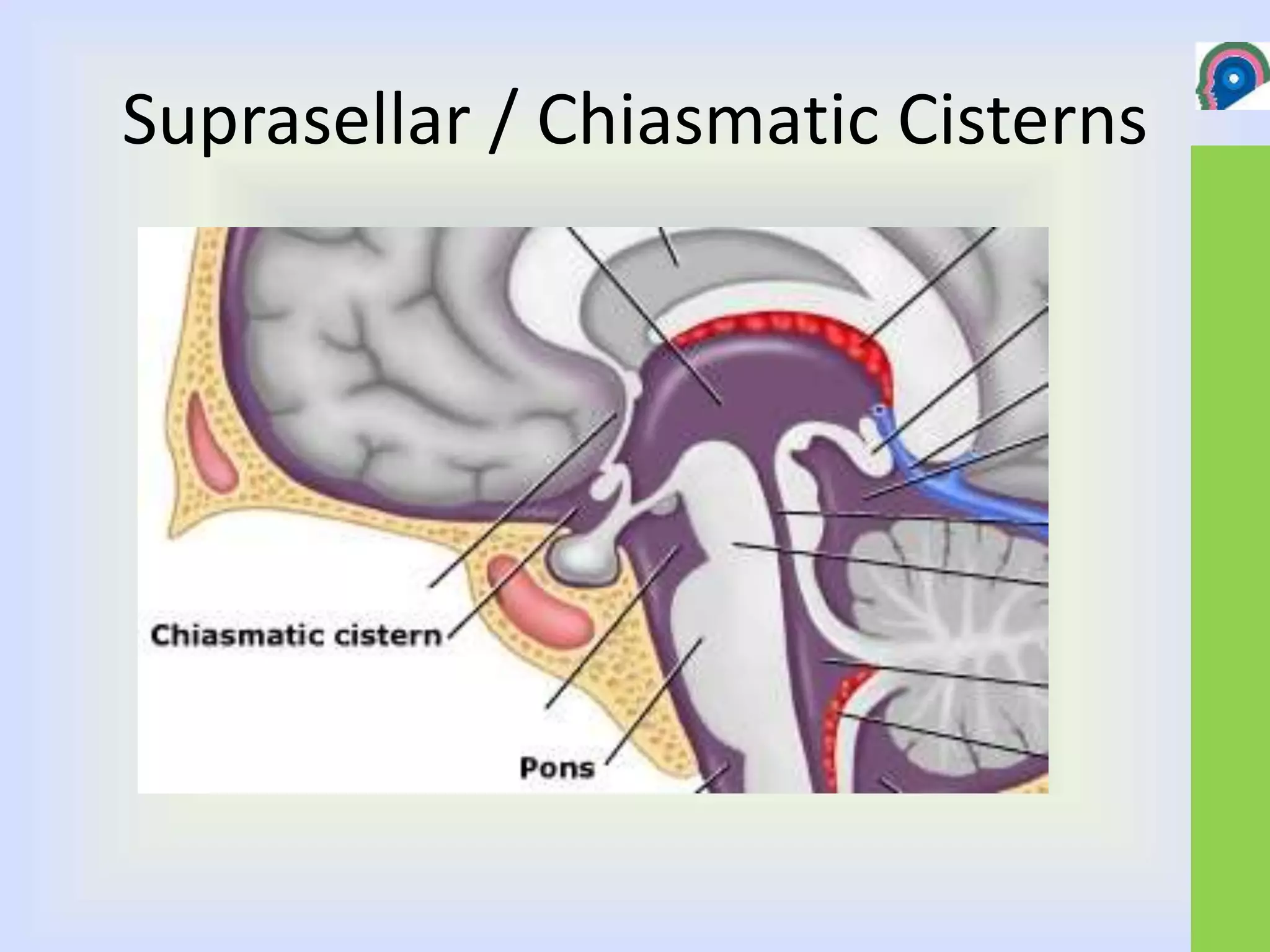 Cisterns of brain | PPTX