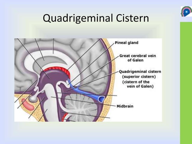 Cisterns of brain | PPTX | Brain and Nervous System Disorders ...