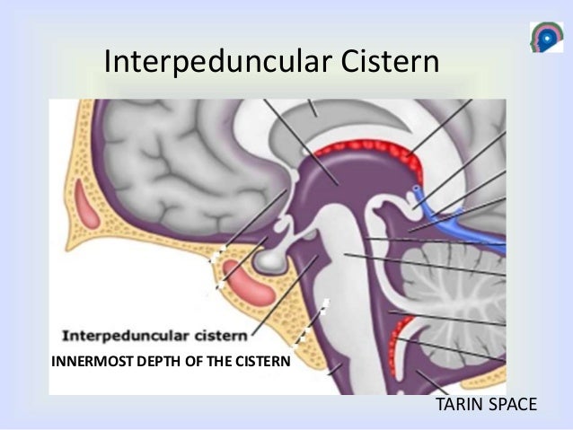 Cisterns of brain