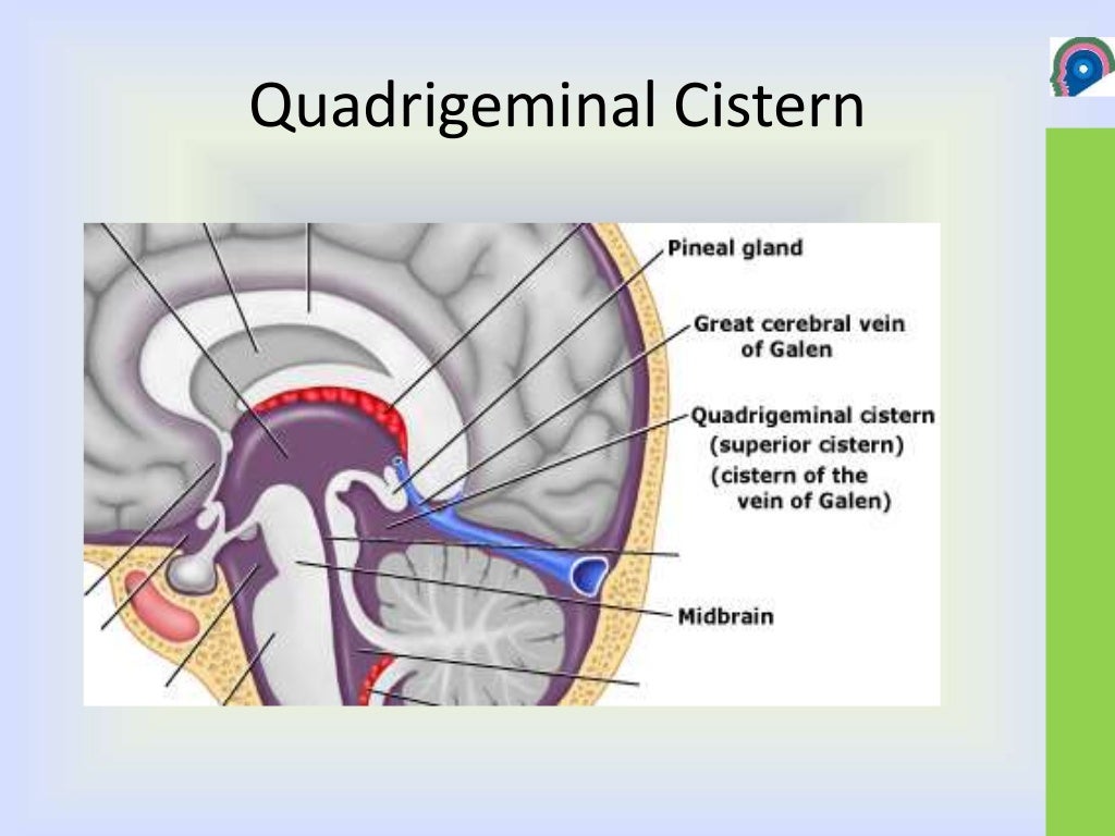 Cisterns of brain