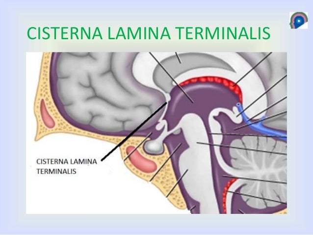 Cisterns of brain