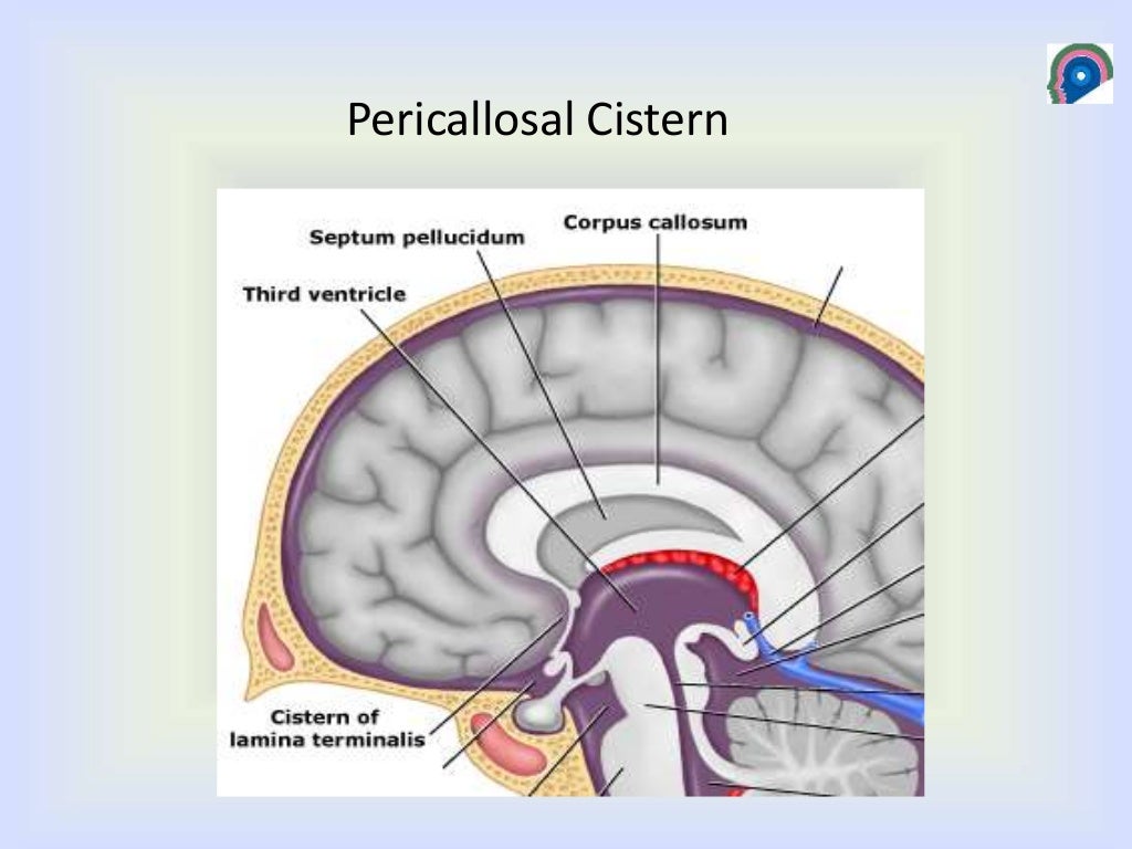 Cisterns of brain
