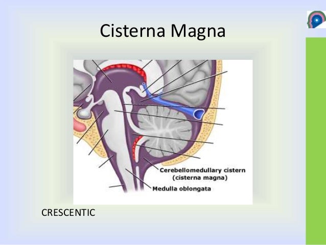 Cisternae Diagram