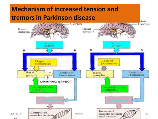 Basal ganalia :Motor function &Deep Brain stimulation (DBS) | PPTX ...