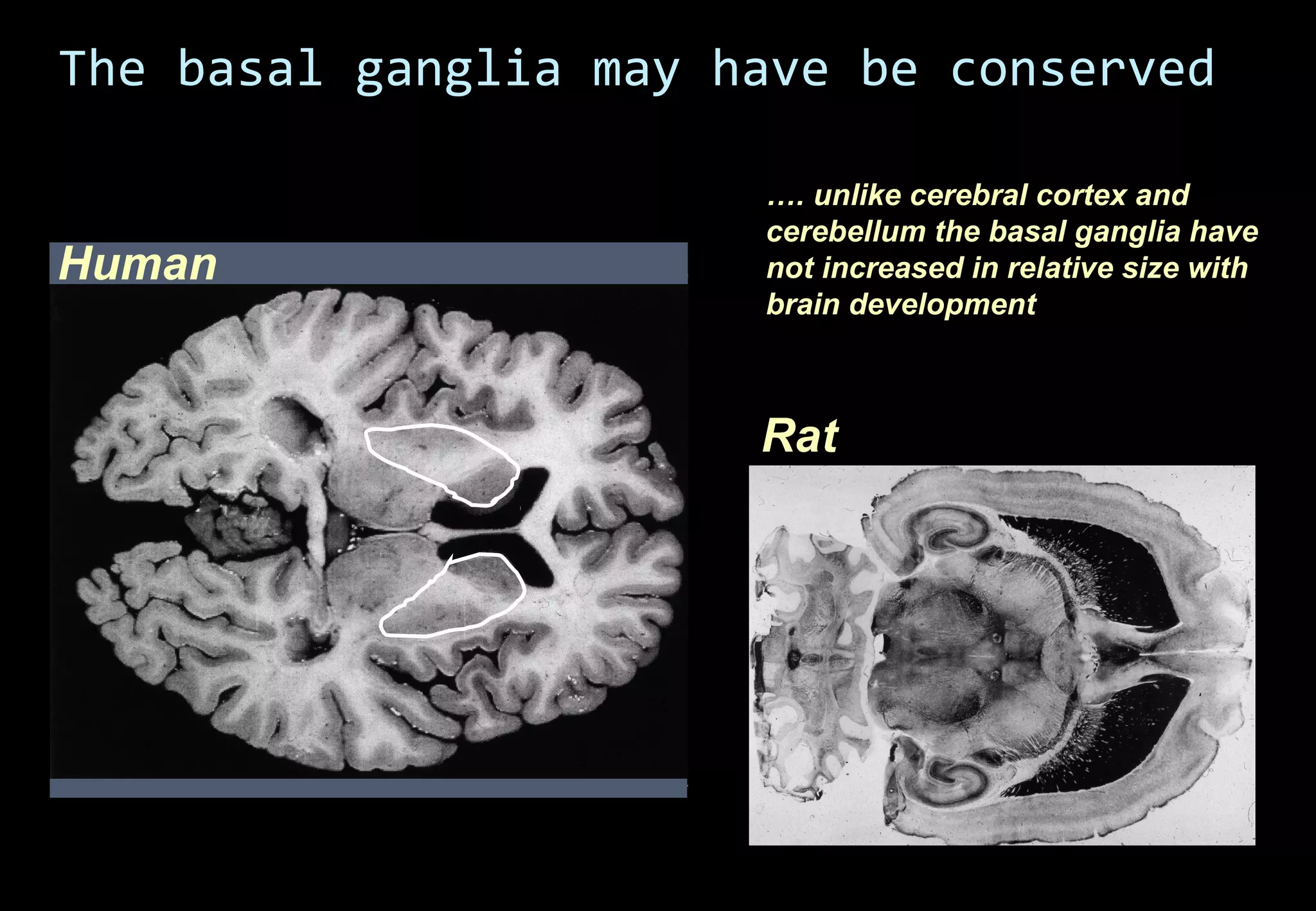 Basal ganglia - Anatomy, Neurochemistry, Connections, Disorders | PPT