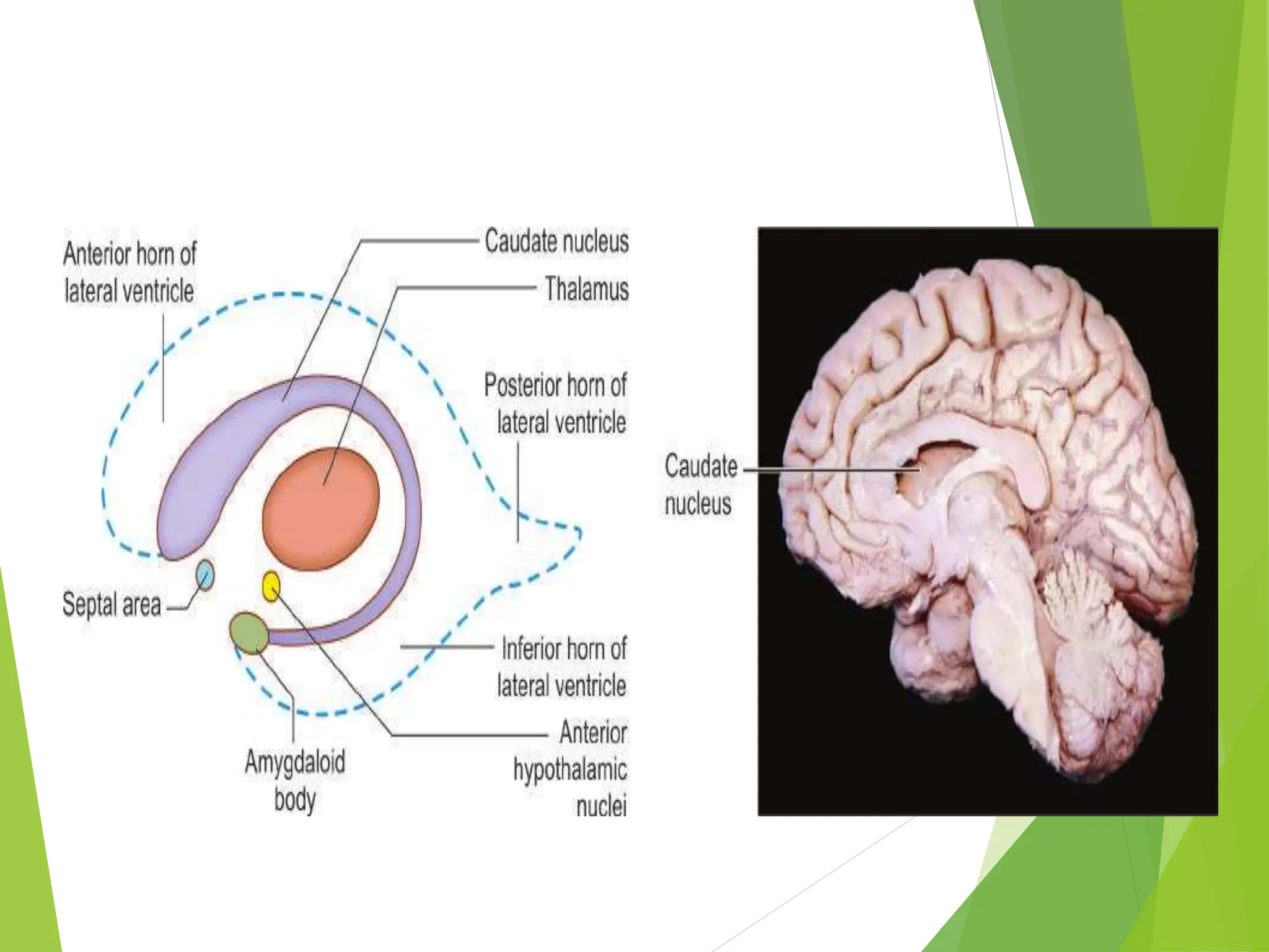 basal ganglia.ppt