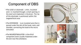 basal ganglia and its circuits connection.pptx