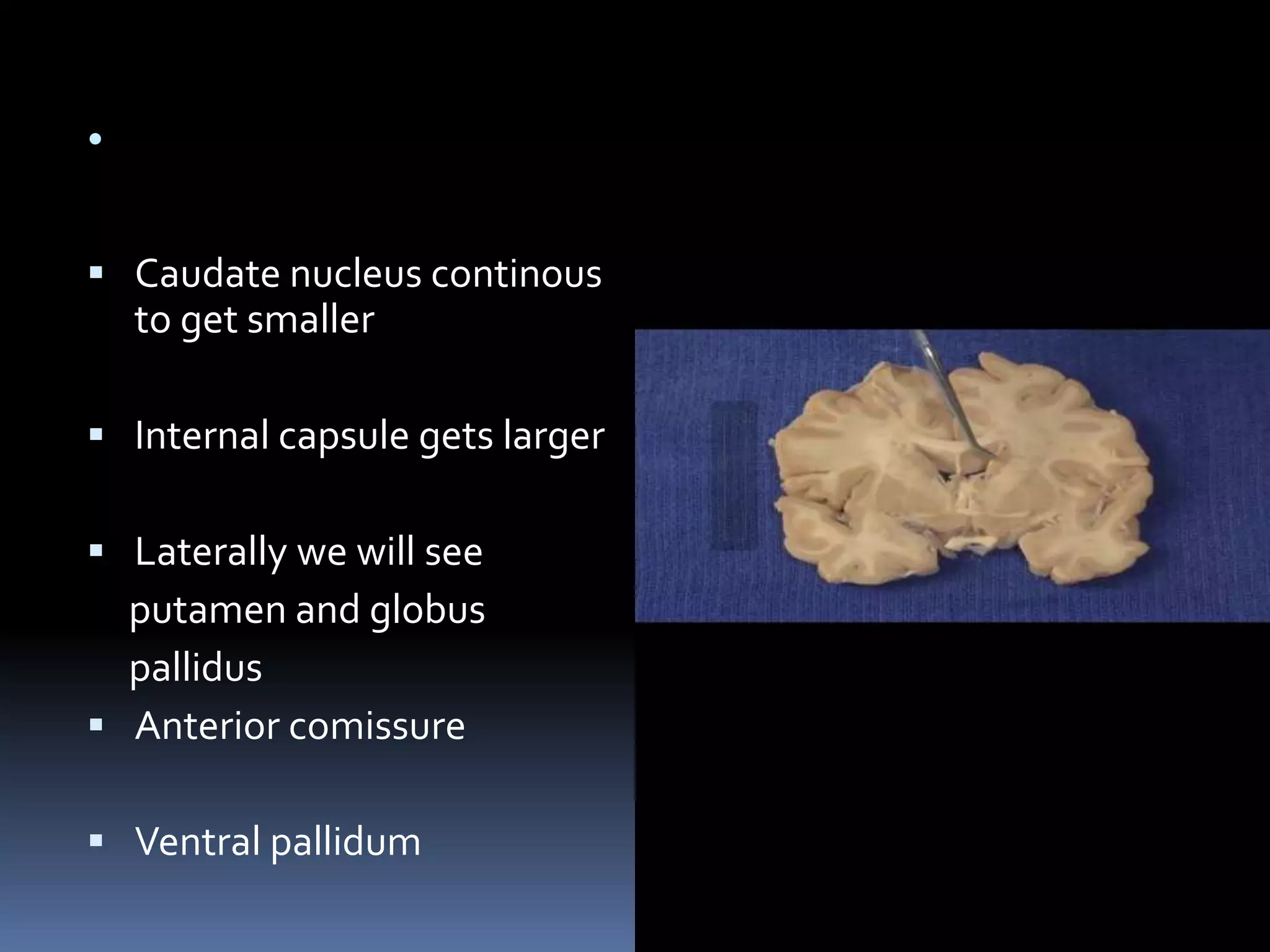 Basal ganglia by Dr.RAJESH PULIPAKA. | PPT