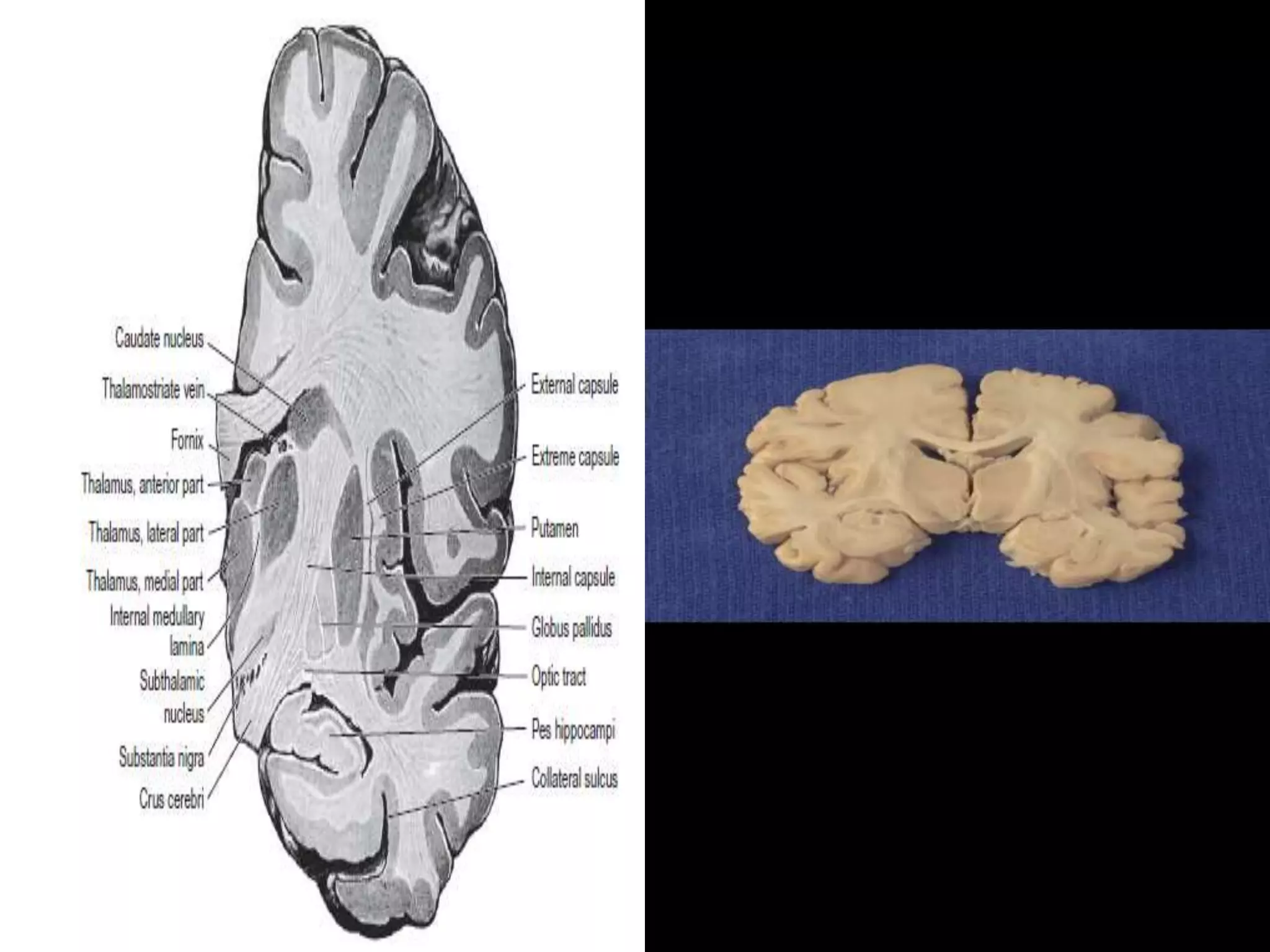 Basal ganglia by Dr.RAJESH PULIPAKA. | PPT