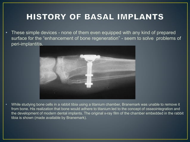 Basal Implant rehabilitation in oral surgery | PPTX | Dental Health ...