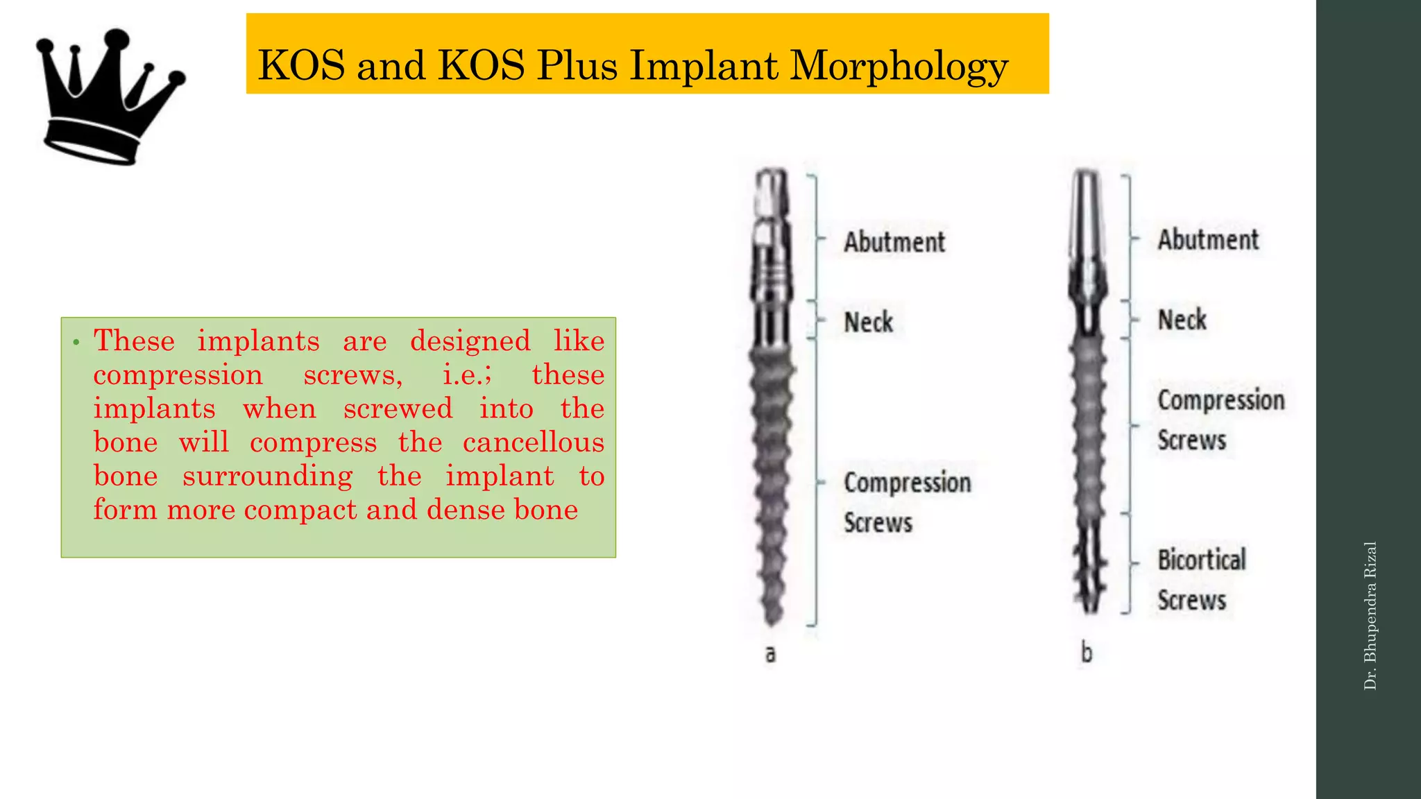 Basal implant - a newer variety of implant system | PPTX
