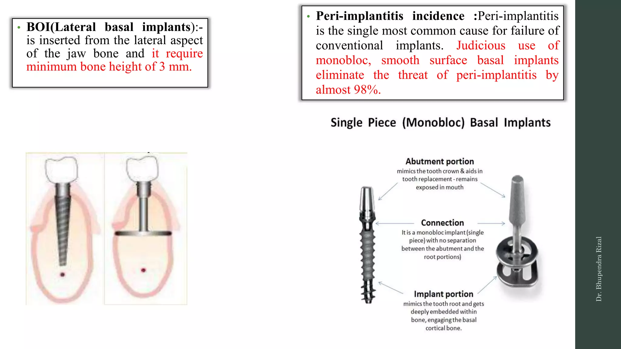 Basal implant - a newer variety of implant system | PPTX