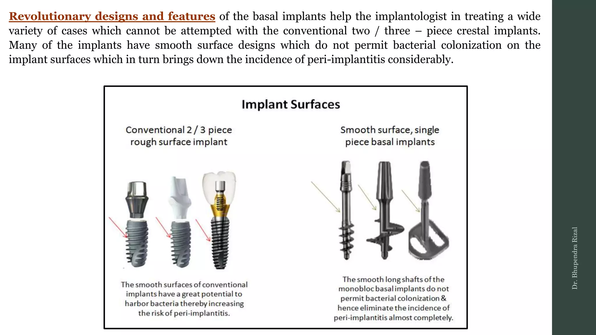 Basal implant - a newer variety of implant system | PPTX