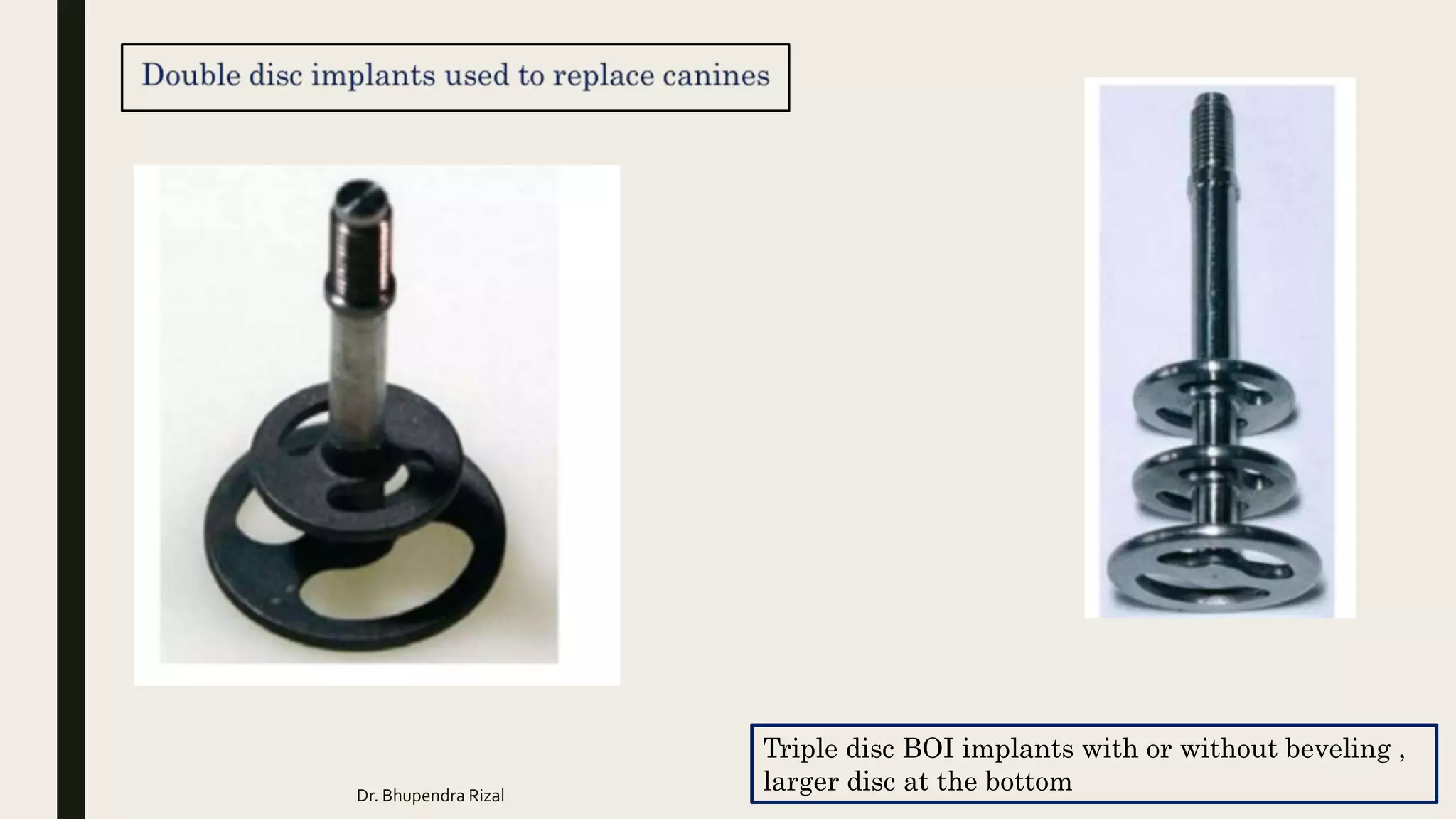 Basal implant - a newer variety of implant system | PPTX