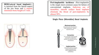 Basal implant - a newer variety of implant system | PPTX